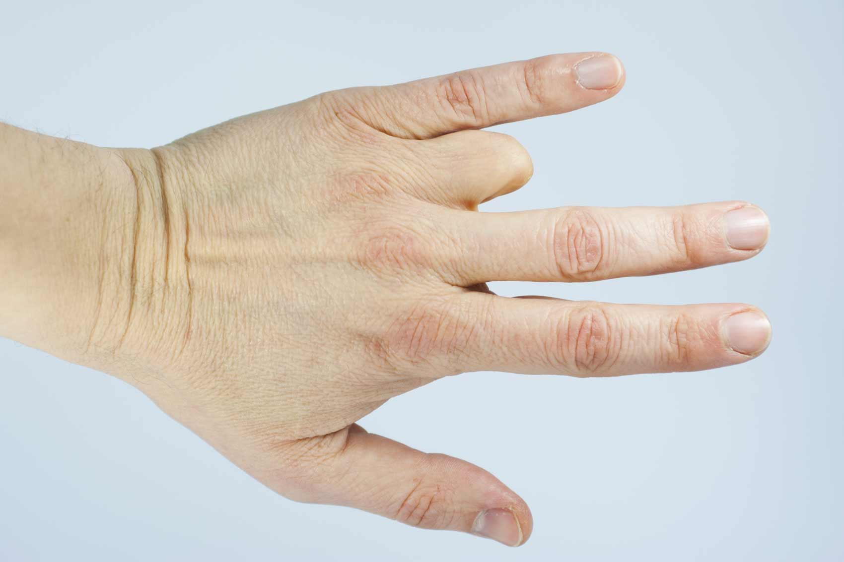 Finger or Hand Amputation · Hand & Ortho